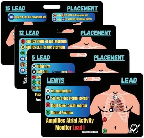 12 Lead Ecg Placement Color Coded Figure 4 Plos One