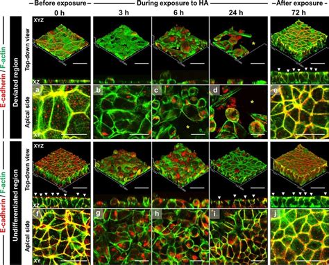 Reorganization Of E Cadherin Associated With The Actin Cytoskeleton In