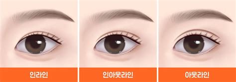 쌍꺼풀 수술 연예인 눈으로 나에게 맞는 쌍꺼풀 라인종류 알아보자 강남언니 1등 성형수술and피부시술 정보앱