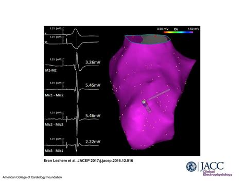 Eran Leshem Et Al Jacep 2017jjacep Ppt Download