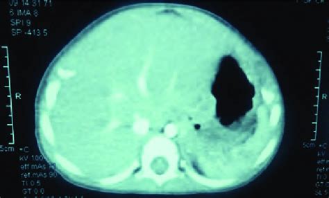 Normal Liver Parenchyma Download Scientific Diagram