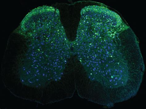 Wearable Microscopes Advance Spinal Cord Imaging In Mice Salk