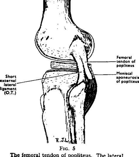 Figure 2 From The Popliteofibular Ligament Semantic Scholar