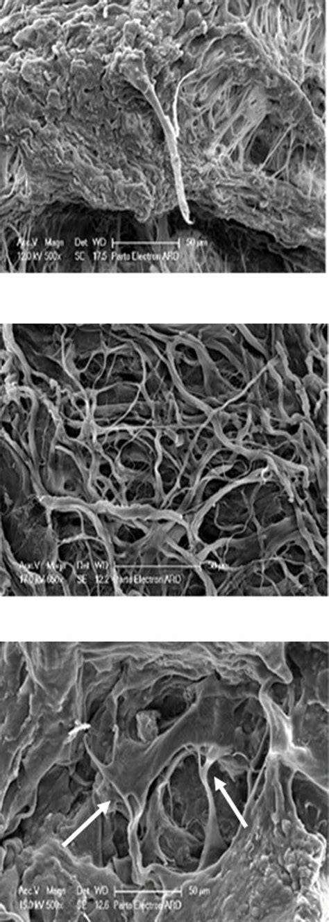 Comparison Of The Construction Of Natural And Decellularized Scaffolds