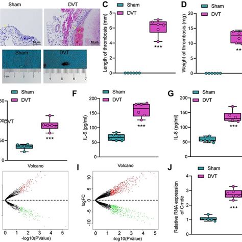 high throughput transcriptome sequencing analysis to screen key genes