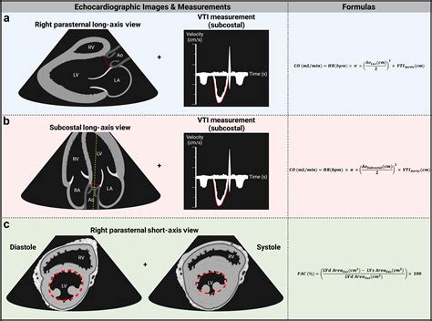 Correlation Agreement And Concordance Of Cardiac Output Estimated By Transthoracic Ultrasound