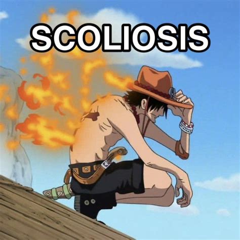 Epic Ace One Piece Anime Artwork