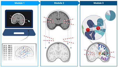 Ieeg Recon — Ieeg Recon 01 Documentation