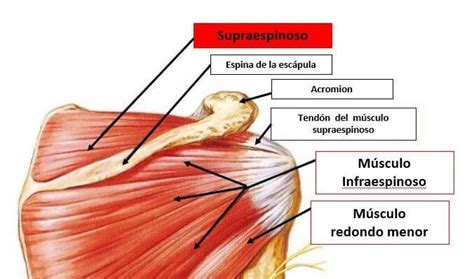 Rotura Del Supraespinoso Tratamiento Yuhep
