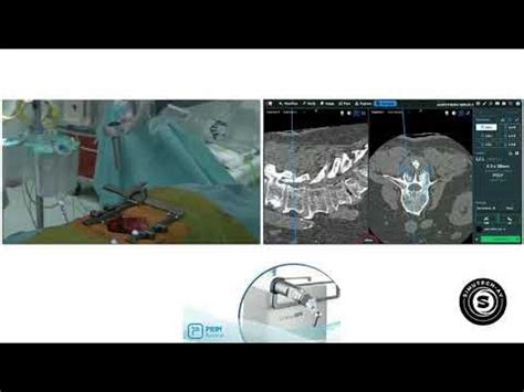Curso cirugía robótica columna vertebral - YouTube