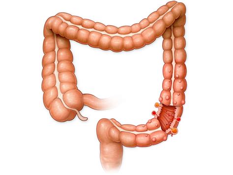 Why Do We Have An Appendix Scientists Have Discovered Its Purpose And
