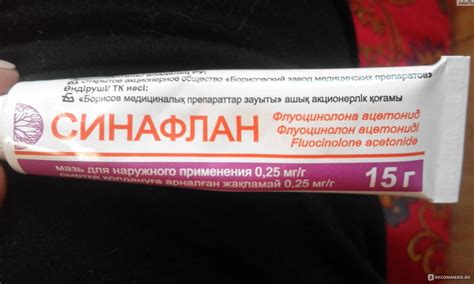Крем от укусов клопов или какое-то средство