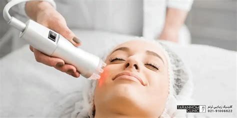 کاربرد و هزینه لیزر فوتونا برای رفع اسکار ، لک صورت و جوش