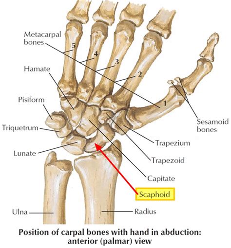 Diagnosing And Treating Scaphoid Fractures Of The Wrist In My Xxx Hot Girl
