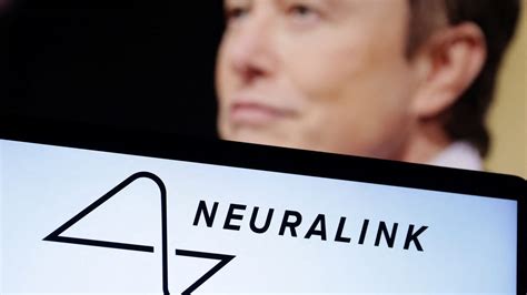 Elon Musk S Neuralink Knew About Brain Chip Design Flaw