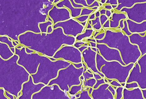 Lyme Disease Borrelia Burgdorferi Bacteria Sem Stock Image C044