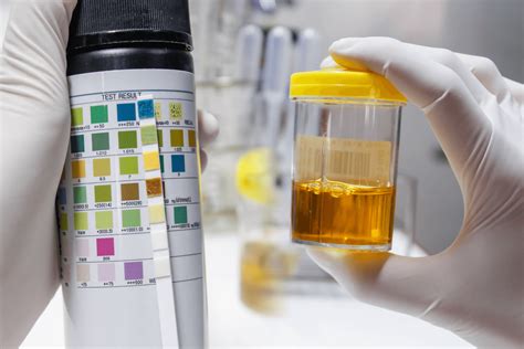 How Long Does Gabapentin Stay In Your System Avenues Recovery