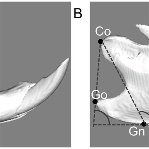 Landmarks And Measurement Items For Linear Analysis A And Angular