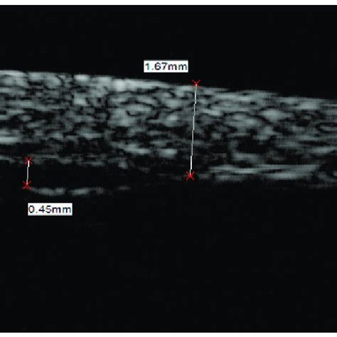 Measured Pulse Echo Response And Fast Fourier Transform Fft Spectrum