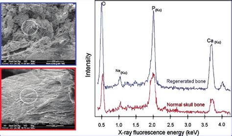 X Ray Fluoroscopic Trace Element Analysis Of A Sem Scan Of The Defect