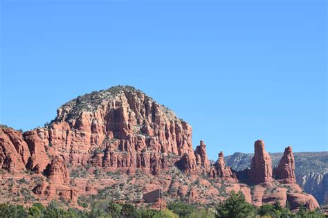 The Vulva Gallery Its Very Common For Labia To Be Asymmetrical