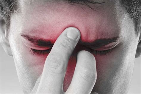 Voc Sabia Que Sinusite Tem Cura Not Cias Cl Nica J Lio Gil Otorrino Sp