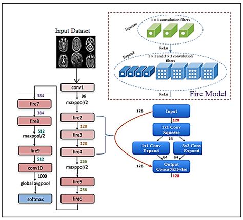A Novel Approach For Classifying Brain Tumours Combining A Squeezenet