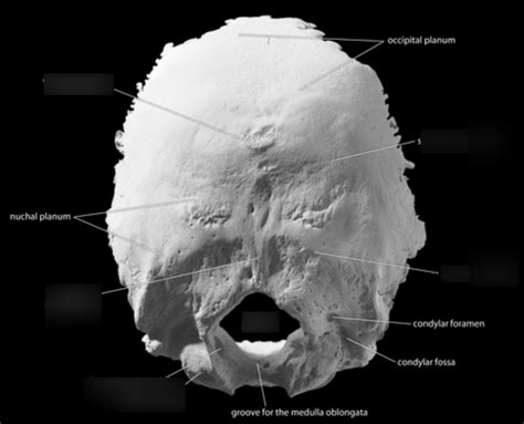 Occipital Ectocrainial View Diagram Quizlet
