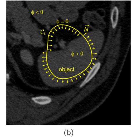 Illustration Of The Level Set Convention And Denotations Using Sample