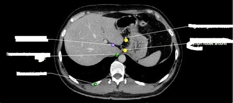 Abdominal Lymph Nodes 4 Diagram Quizlet
