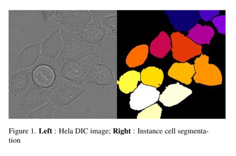 U Net网络变形综述unet综述 Csdn博客 U Net网络变形综述unet综述 Csdn博客