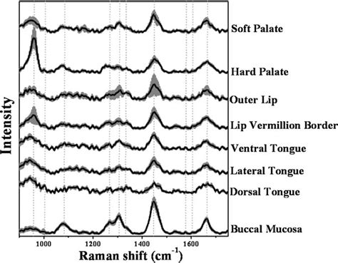 Mean Normalized Raman Spectra Of The Different Anatomical Sites Of Download Scientific Diagram