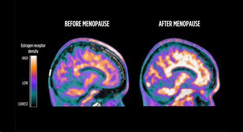 Menopause More Estrogen Receptors In The Brain Techzle