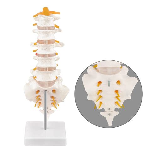 Ultrassist Modelo De Columna Vertebral Humana Con V Rtebras Lumbares Herniaci N Nervios