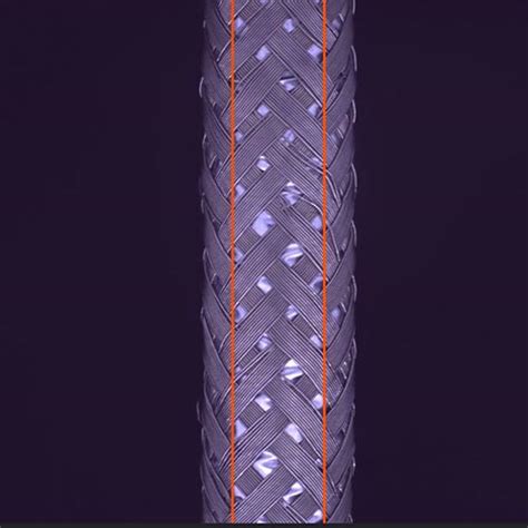 Braiding Defect Inspection Camera Based Quality Control Taymer Vision Systems