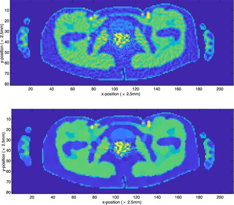 Figure 5 From Improved Multiplicative Regularization For Csi Ept