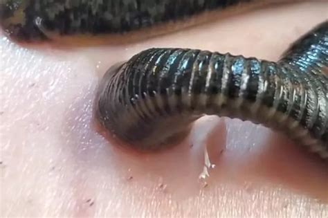 Woman Keeps Leeches As Pets And Even Lets Them Suck