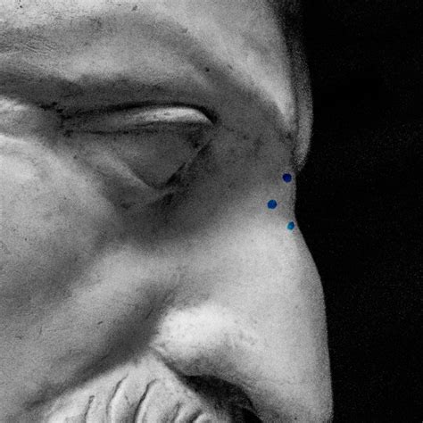 Medicina Estetica Firenze E Prato Dottssa Serena Ghezzi