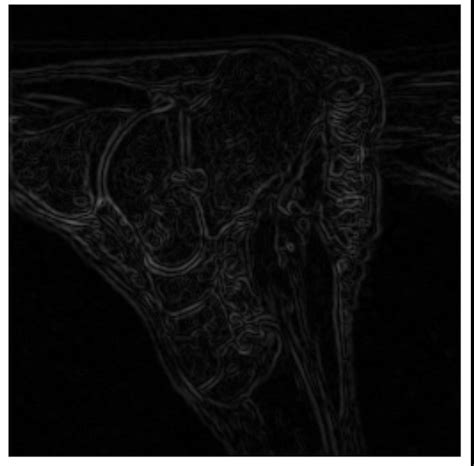 Gradient Magnitude Of Figure 1 With Different Filters The Brightness
