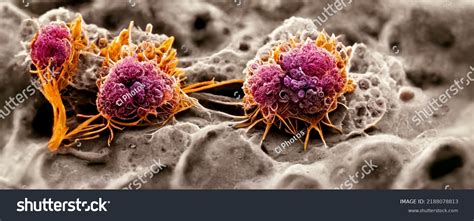 Cancer Cells Destroyed By Oncogenic Virus Stock Illustration 2188078813
