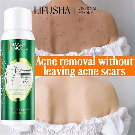 بزم بیوتی اسپری درمان جوش بدن