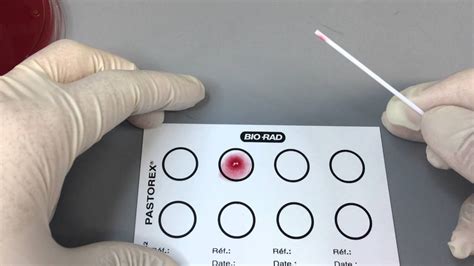 Staphylococcus Lugdunensis Latex Agglutination Test Updated Youtube
