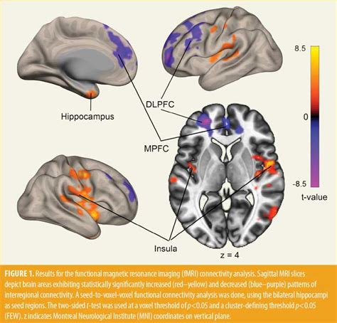 Ecomeditation Modifies Brain Resting State Network Activity Innovations In Clinical Neuroscience