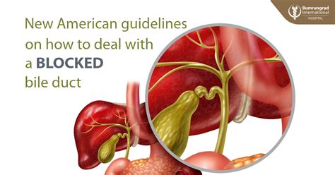 Cholangitis Meaning Bile Duct Diseases Harvard Health