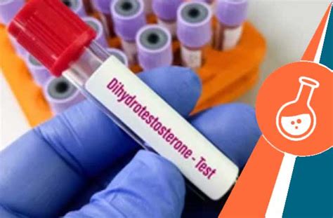 Book Dihydrotestosterone Test Online 30 Off On Dth Test Price