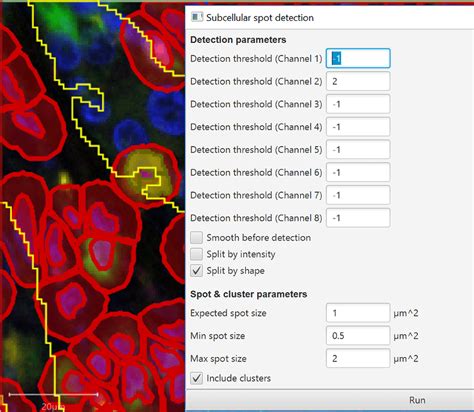 QuPath Accurate Cytoplasmic Stain Measurements Image Analysis Image Sc Forum