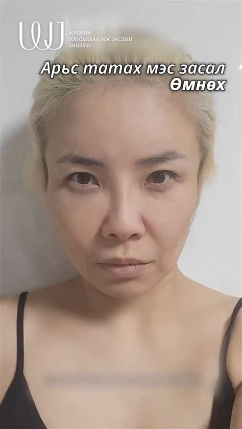 📌Залуужуулах нүүрний арьс татах мэс заслын мэргэшсэн эмч 📌 Солонгосын гоо сайхны салбарт