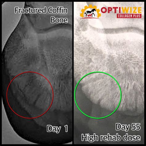 X Rays And Ultrasounds Optiwize