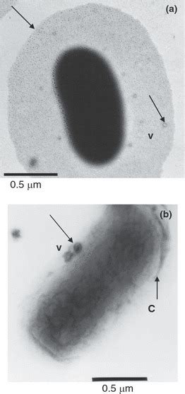 Transmission Electron Microscopy Of Bacteroides Strains Arrows Show