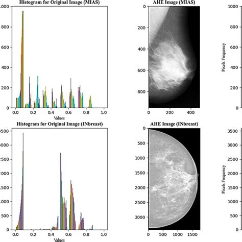 Mammogram Split Up In Mias And Inbreast Datasets Download Scientific